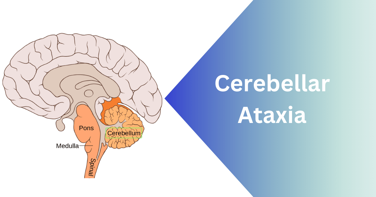 What Is Cerebellar Ataxia? - Alma Chopra